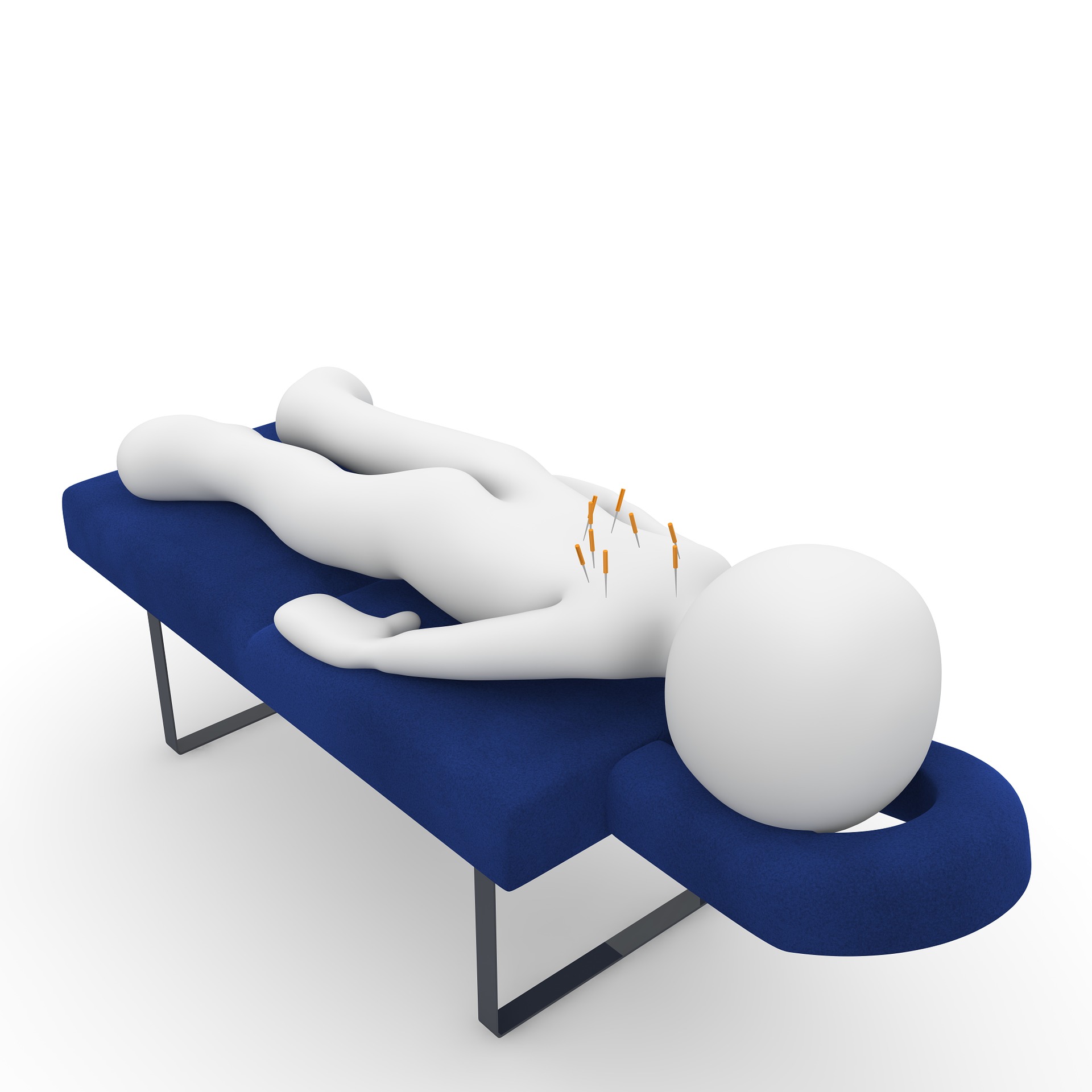 Acupuncture – Devon Physical Therapy